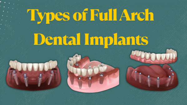 Types of Full Arch Dental Implants: Which Option is Right for You? - crystalline Dental