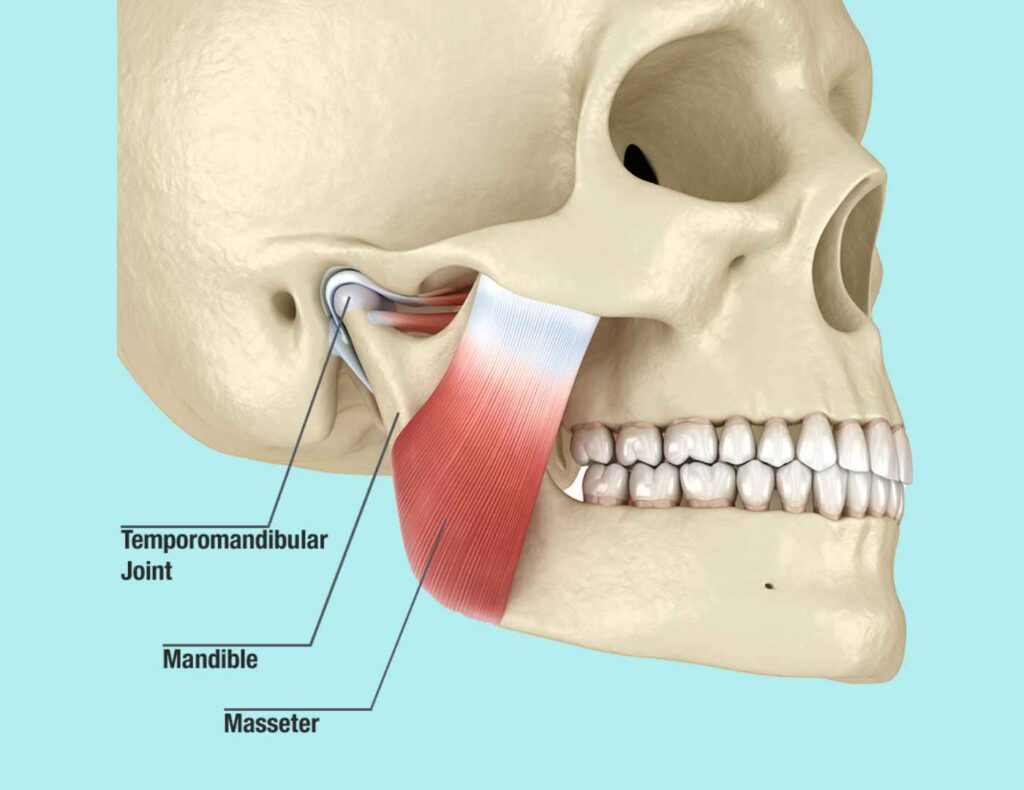 Botox and TMD therapy